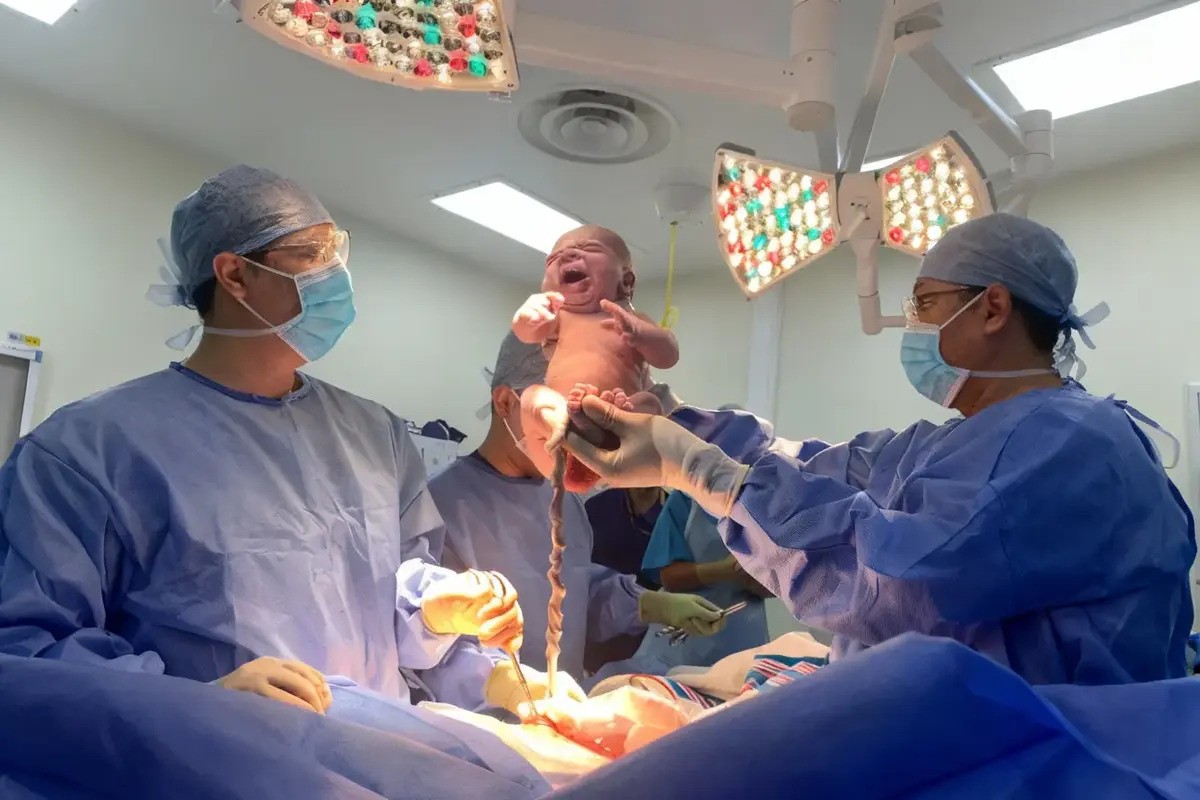 Operasi Caesar - Prosedur, Tujuan, Efek, dan Biayanya - Tzu Chi Hospital