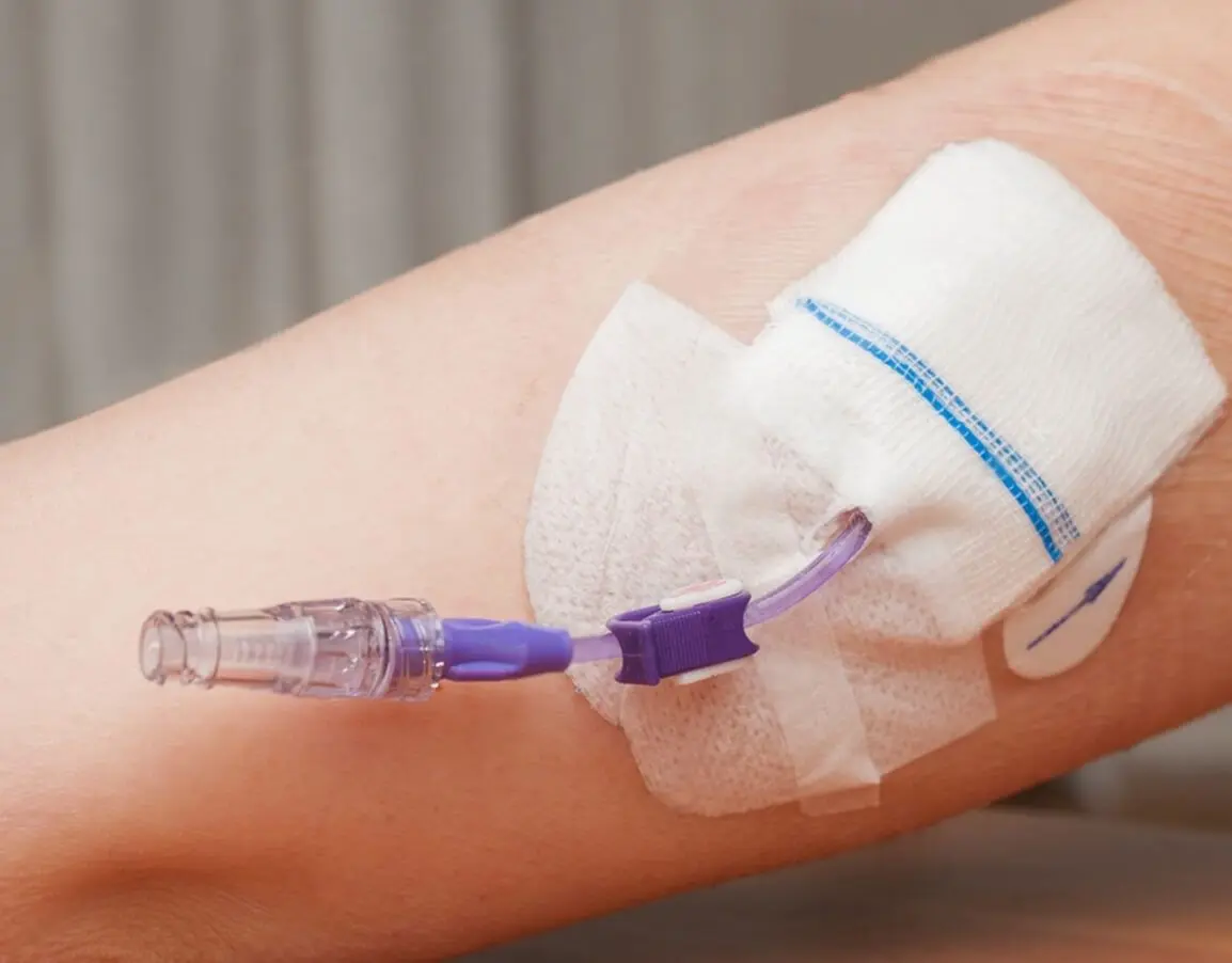 10 Alat Kemoterapi: Chemoport, Kanula, hingga Portacath - Tzu Chi Hospital