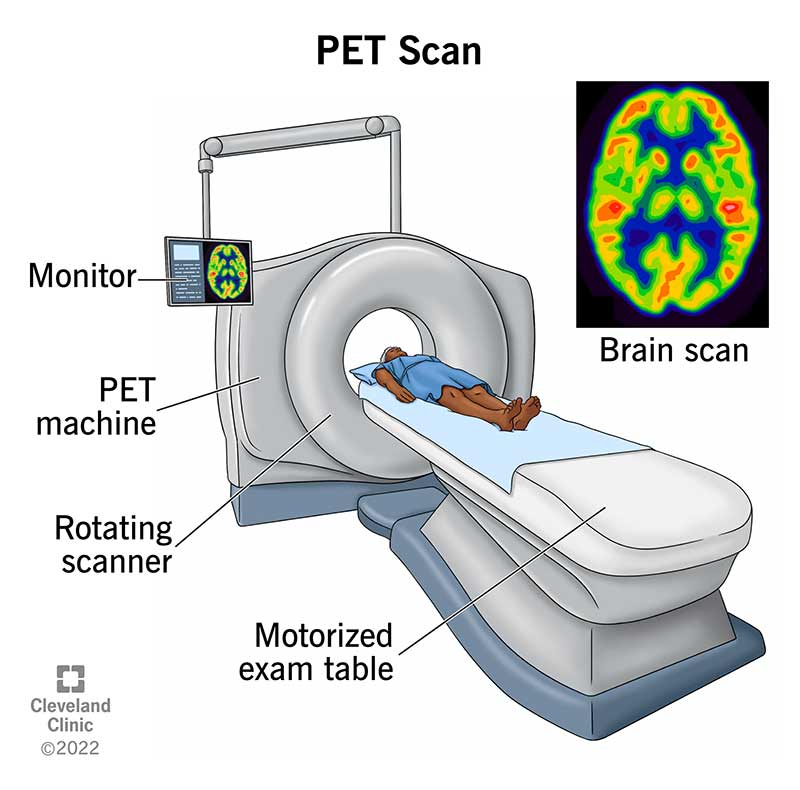 PET Scan: Kenali Arti, Prosedur, Biaya, & Risikonya - Tzu Chi Hospital